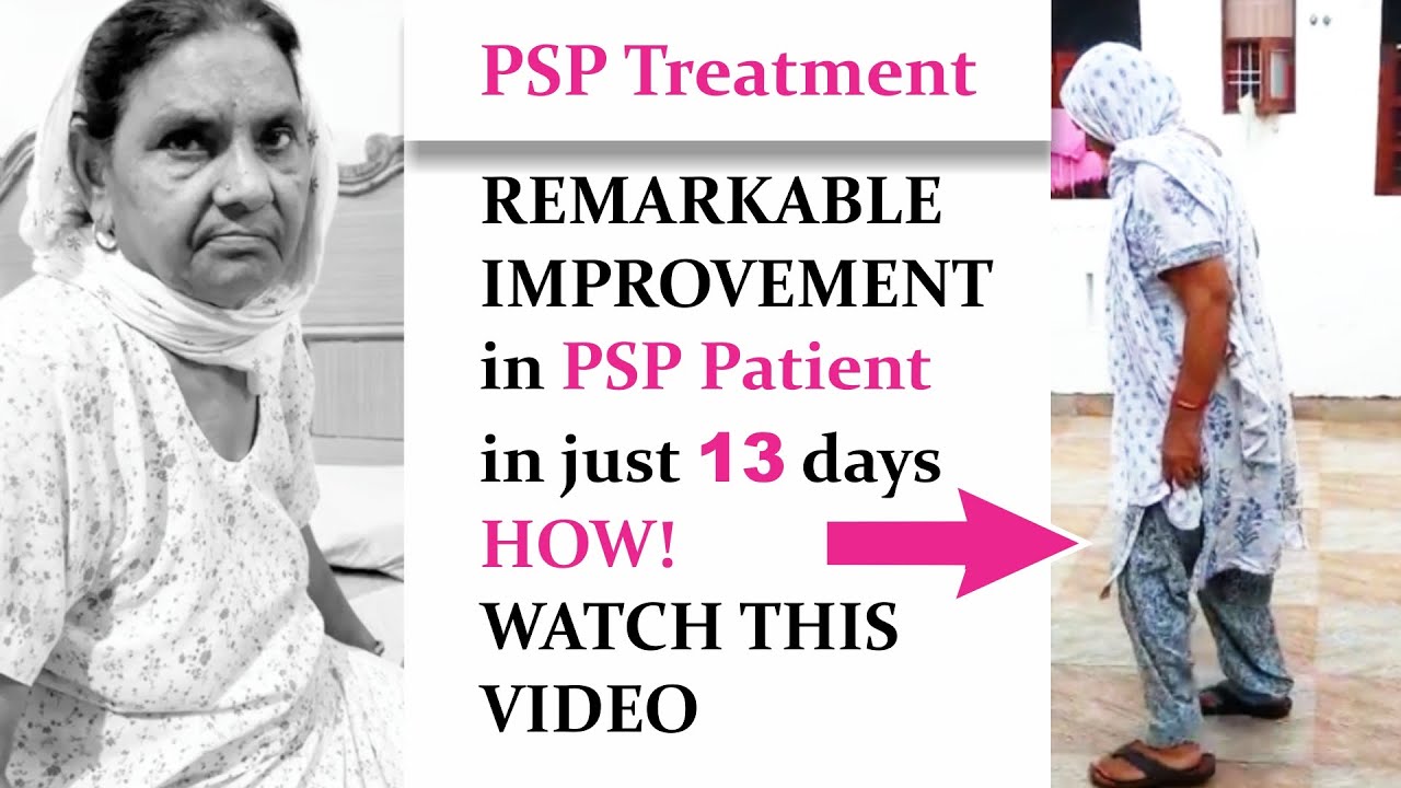 350th Patient of PSP | Patient's Speech, Walking & Confidence have ...