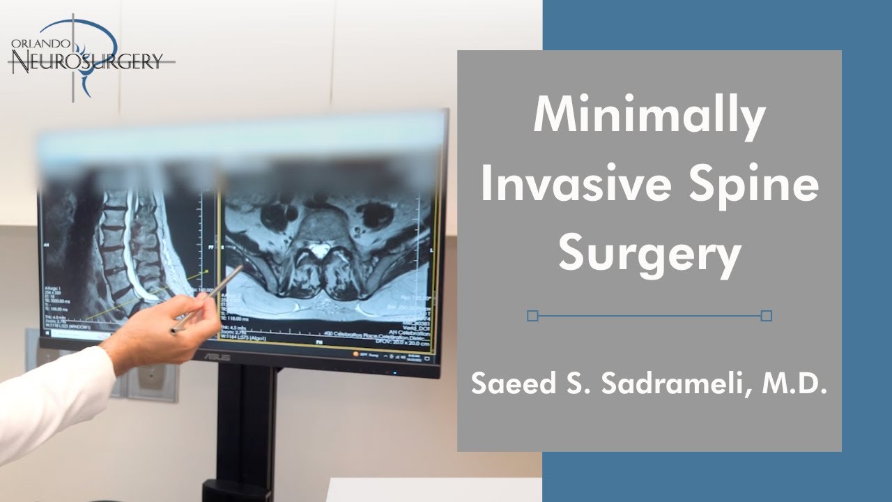 Minimally Invasive Surgery For Lumbar Spinal Stenosis – WDXO