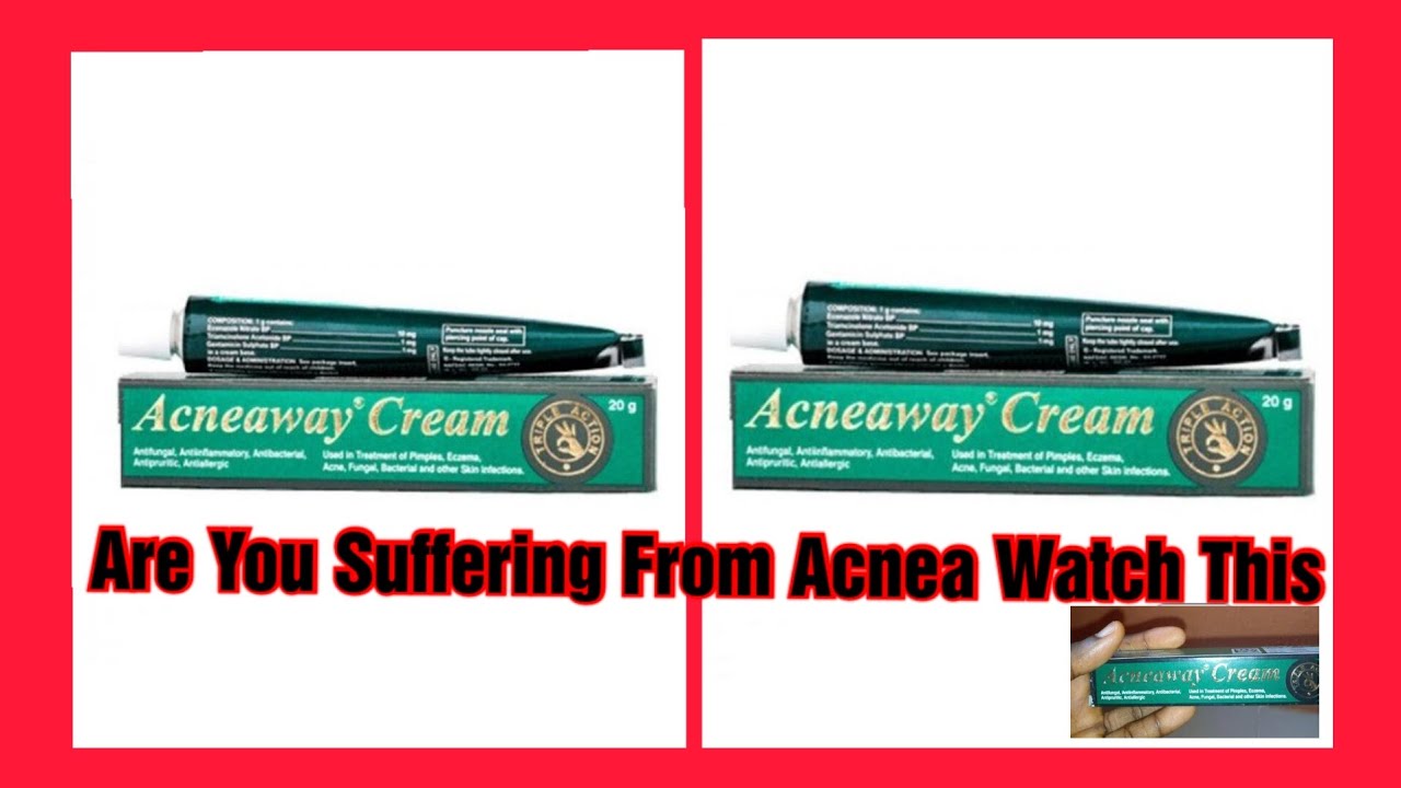 What Acneaway Cream Does To The Face * Watch Till The End* #review ...
