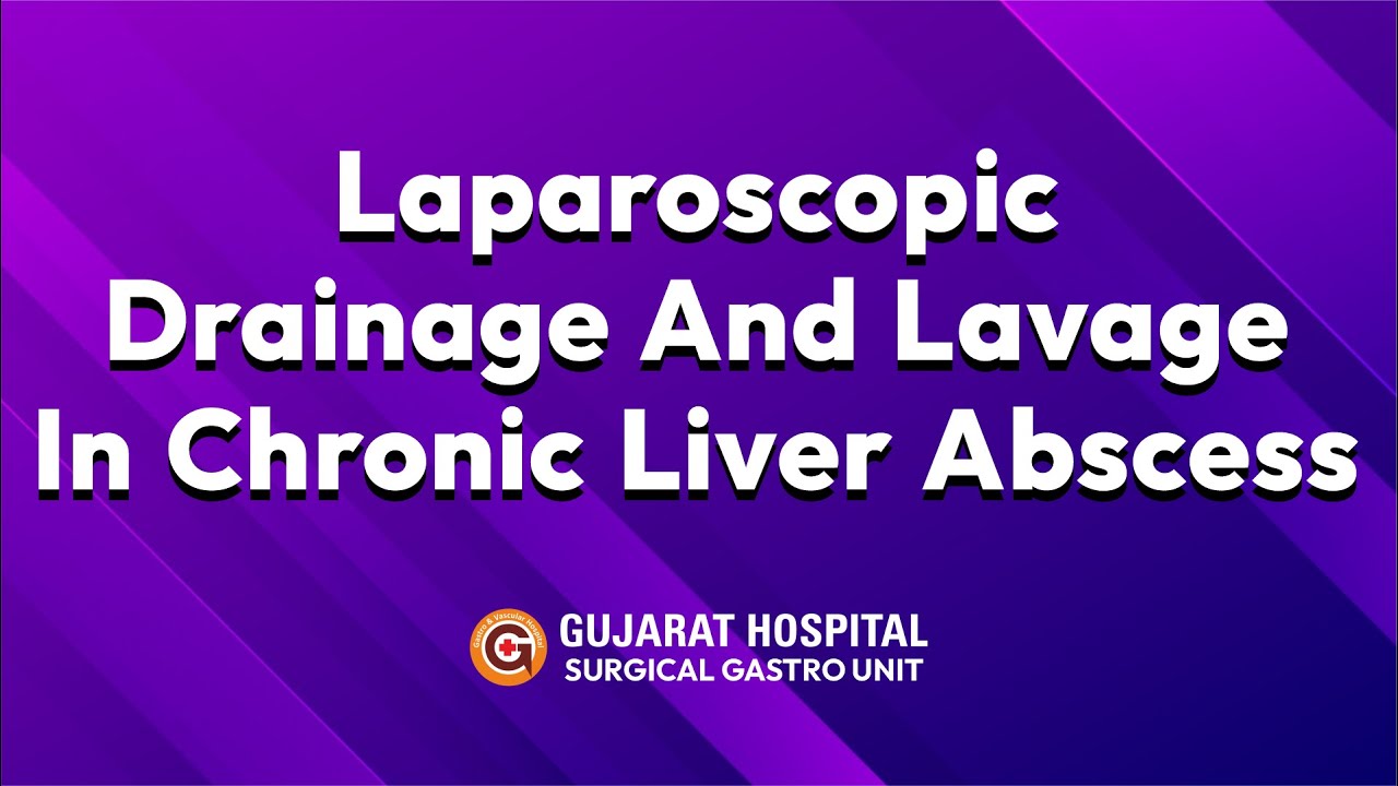 Laparoscopic drainage of liver abscess - YouTube