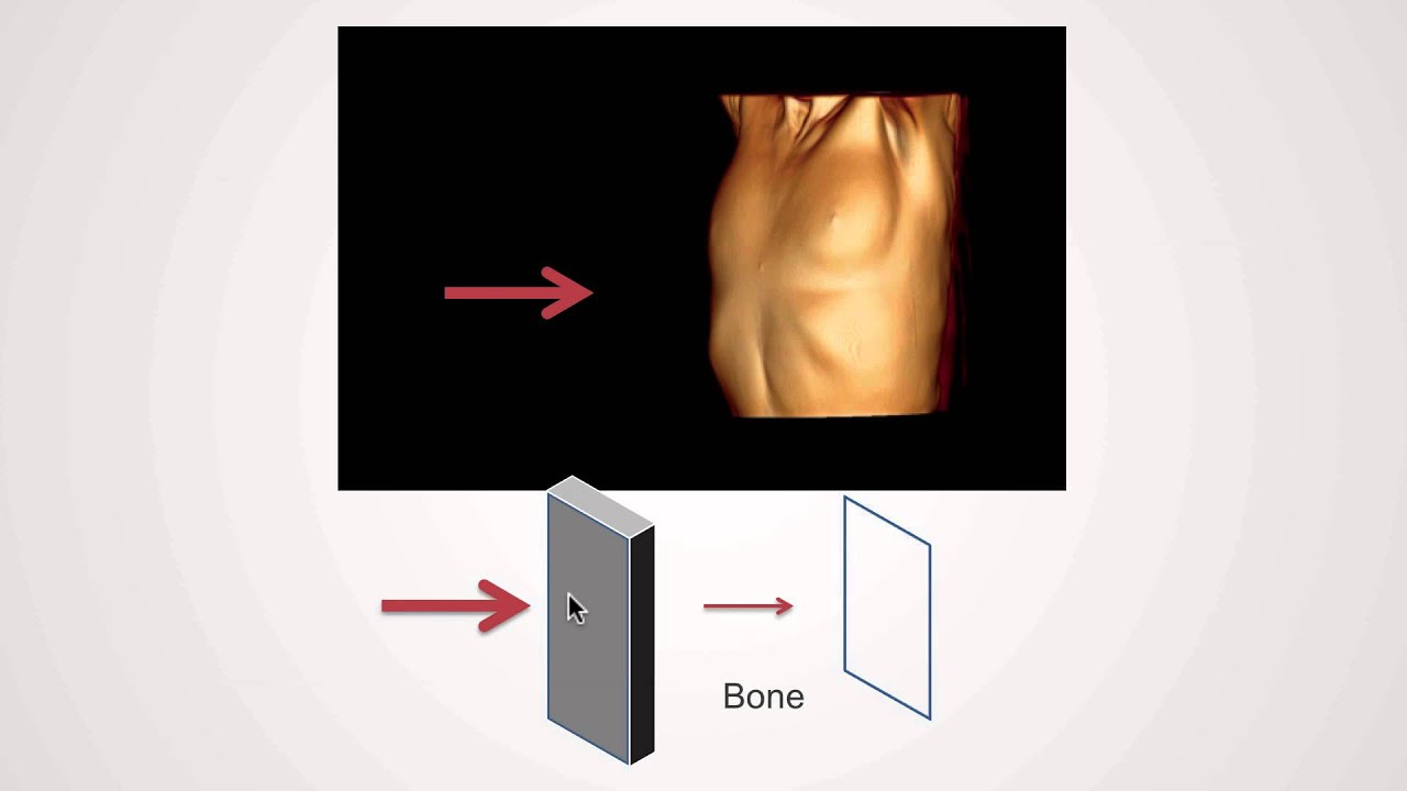 Getting into the chest X-ray: The importance of greyscale (part 1 ...