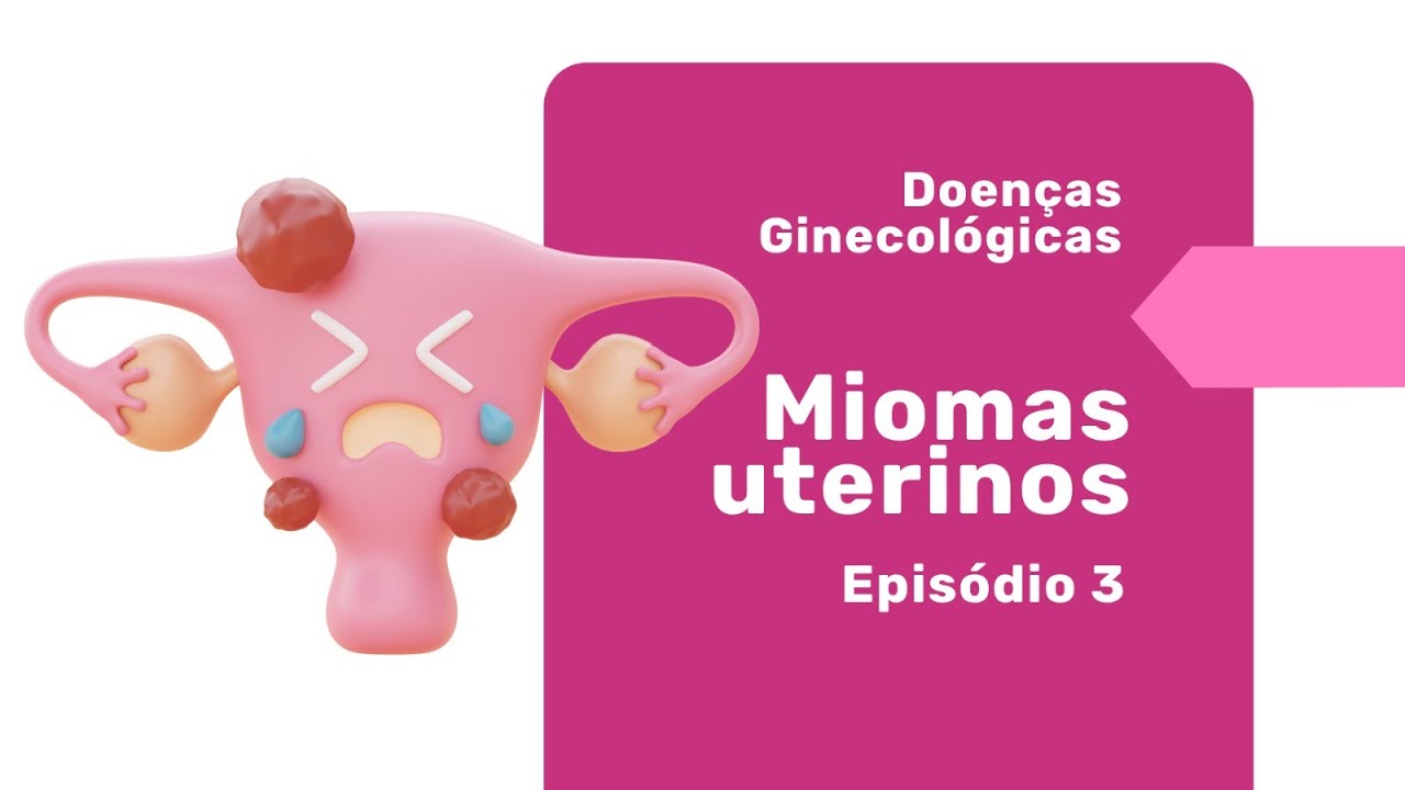 Alerta: sintomas de Miomas Uterinos que você não deve ignorar! - YouTube