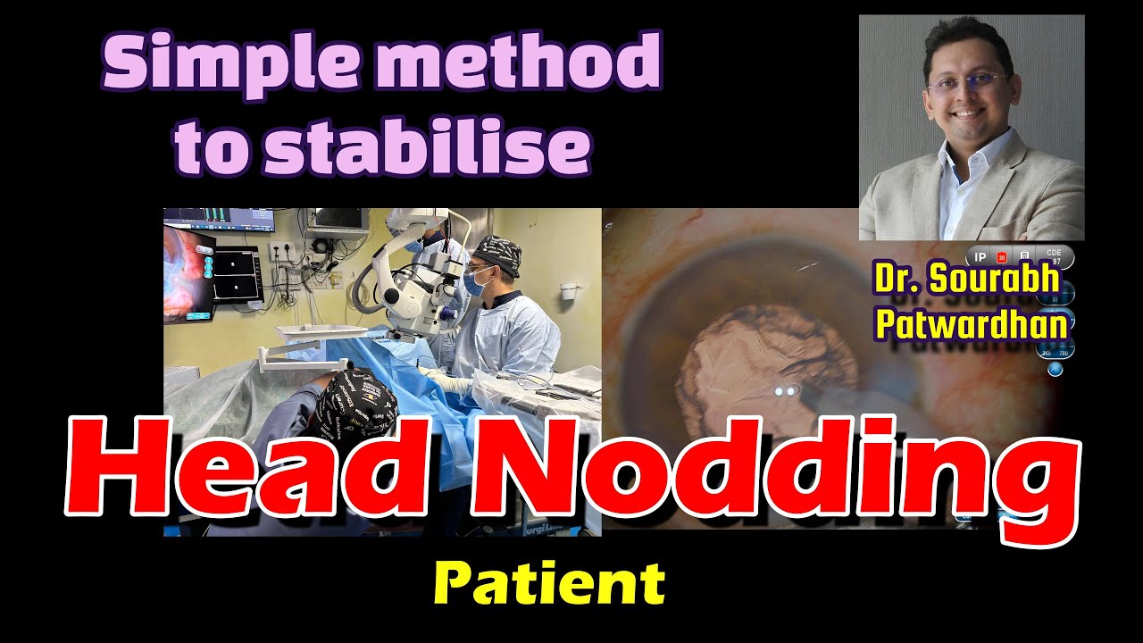 315 Head nodding: Simple method to solve the problem- Dr Sourabh ...