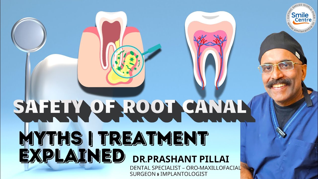 Safety of Root Canal | Myths | Treatment Explained | Dr.Prasanth Pillai ...