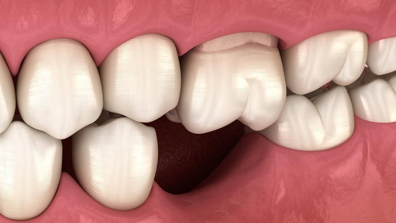 KIDNEY JING (ESSENCE) DEFICIENCY - YouTube