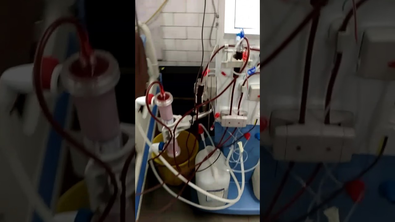 Dialysis machine ak98 gambro nrs - YouTube