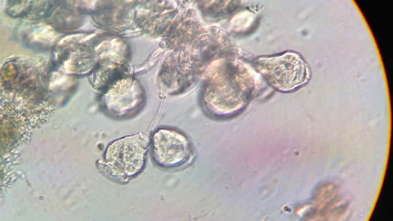 Stalked Ciliates - YouTube