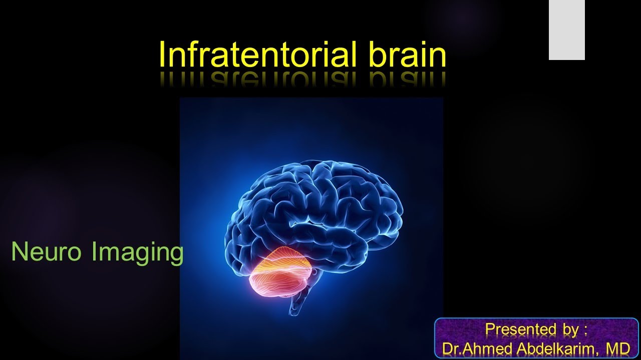 2-Anatomy of the infratentorial brain - YouTube