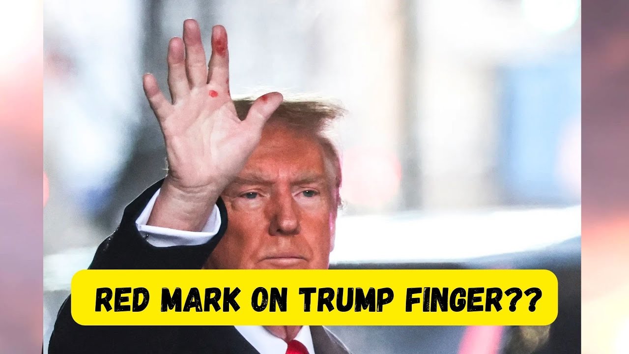 Red marks on Trump fingers?? - YouTube