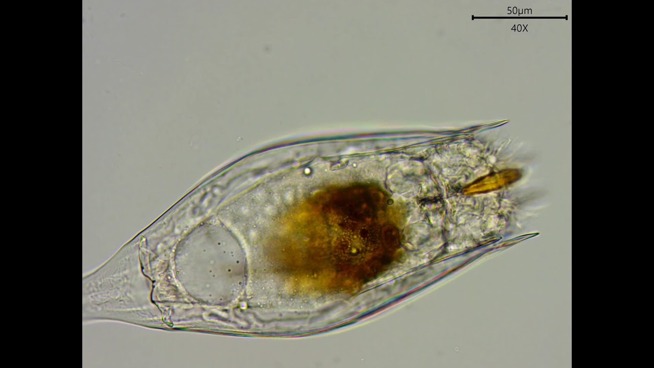 Rotifer Notholca acuminata - YouTube