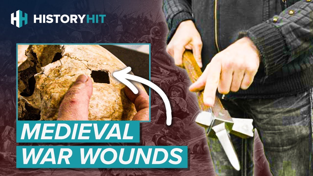 These Skeletons Reveal Horrific Injuries From The Battle of Towton ...