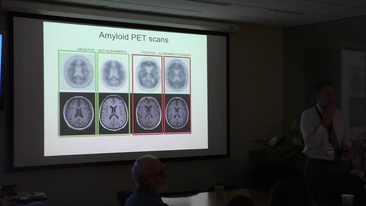 Thomas Grabowski, MD - Alzheimer's Disease Update - YouTube