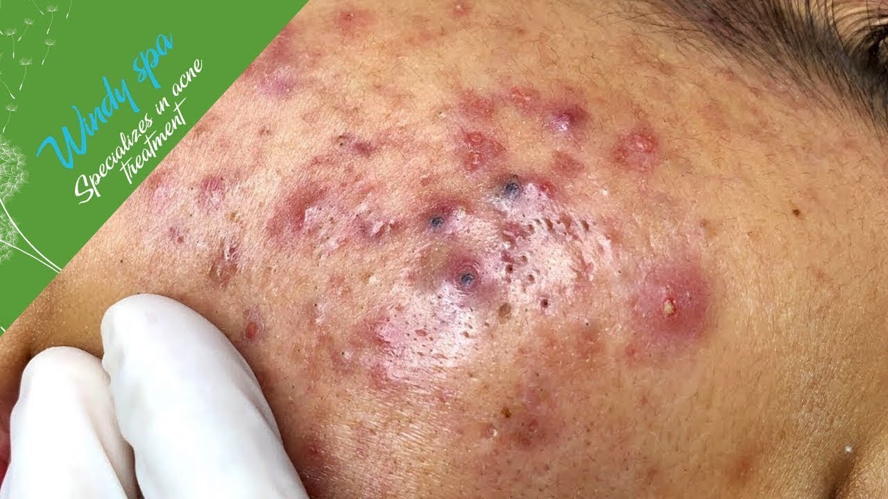 Make Your Day Relaxing with Windy Spa#12 - YouTube