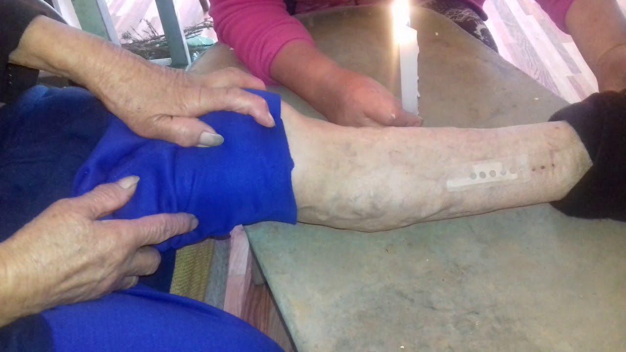Terapia kambo procedimiento inicial - YouTube