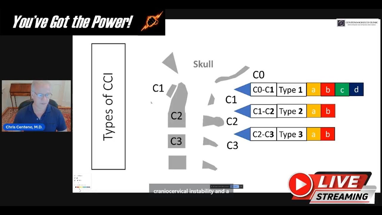 The Transverse Ligament: Type 2a CCI - YouTube