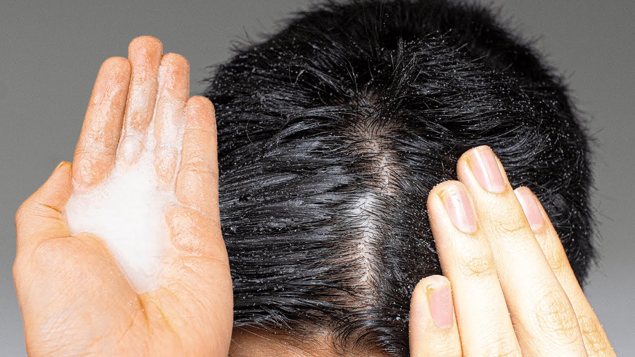 Combate el hongo y la caspa ¡Solo 3 ingredientes! - YouTube