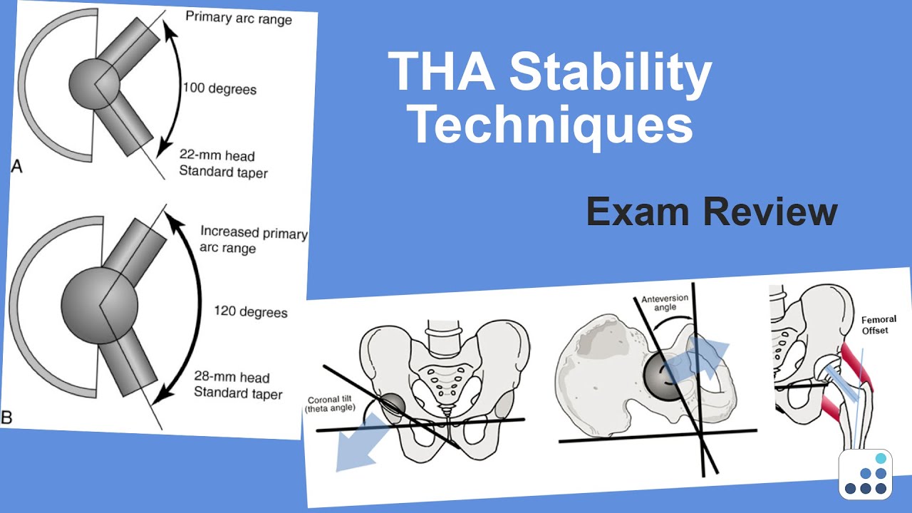 THA Stability Techniques Exam Review - William Griffin, MD - YouTube