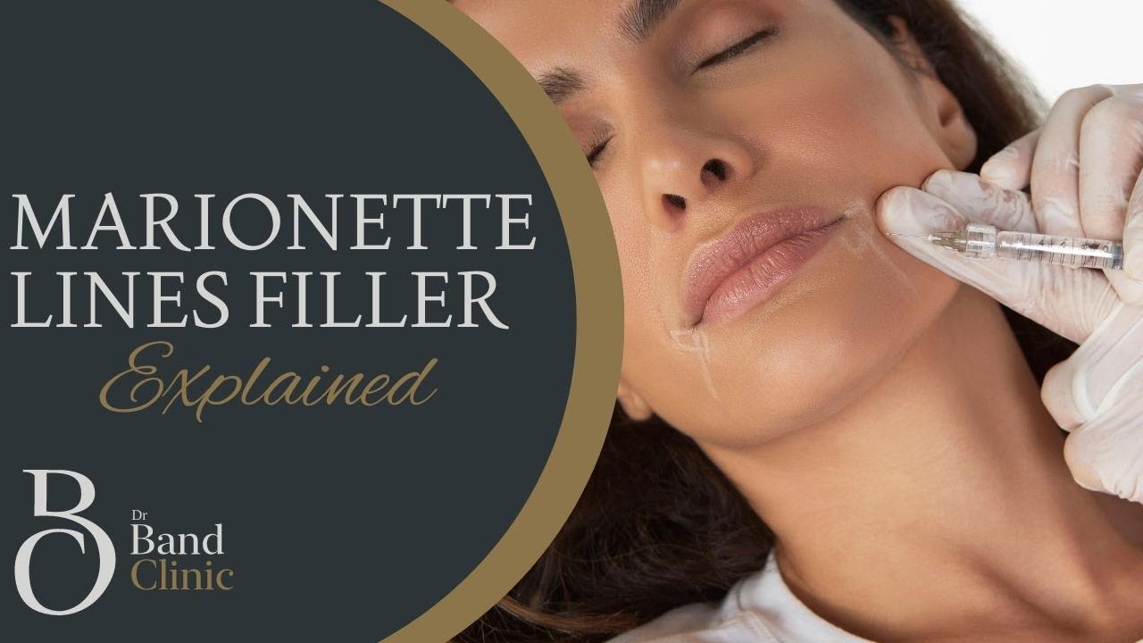 Marionette Lines Filler Explained by Cosmetic Doctors - YouTube