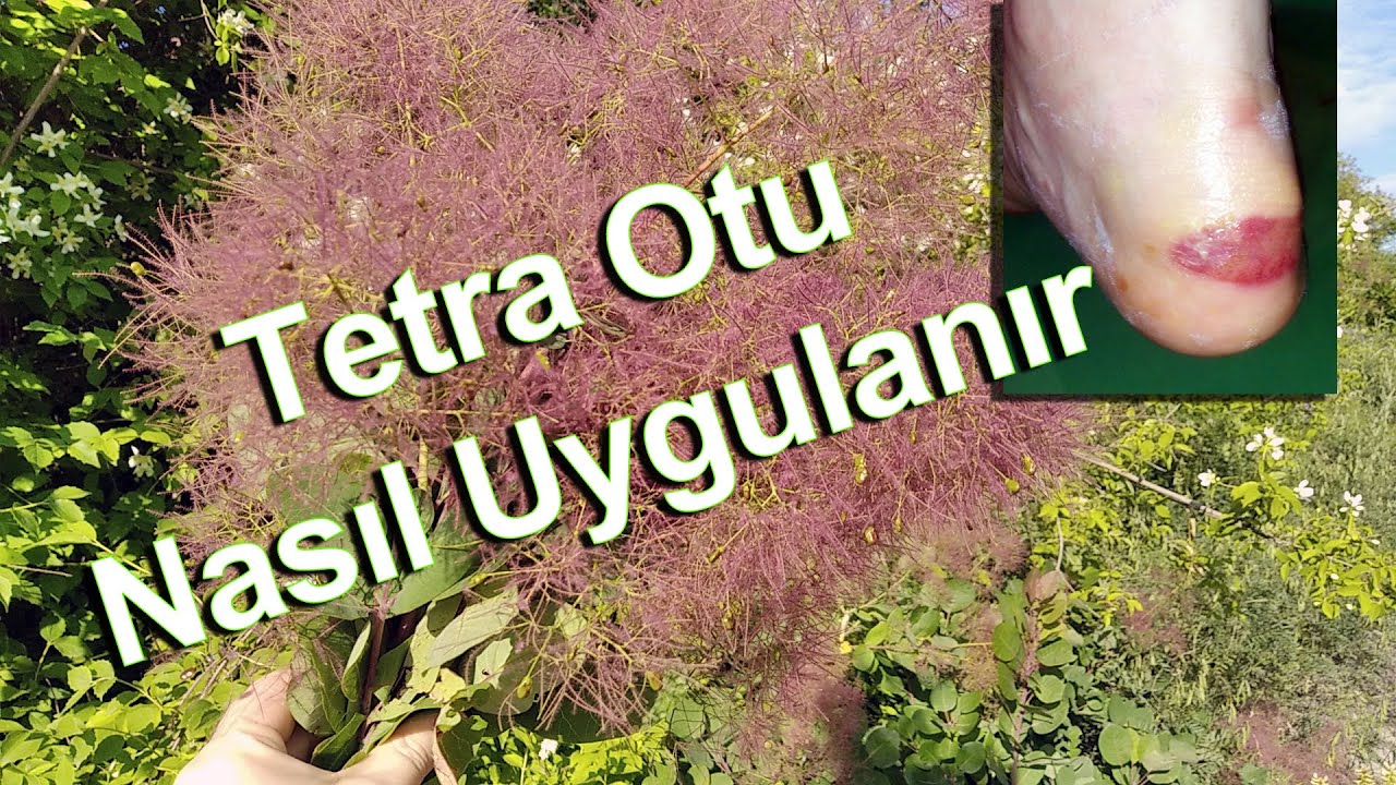 Tetra Otu Haricen Nasıl Uygulanır - YouTube