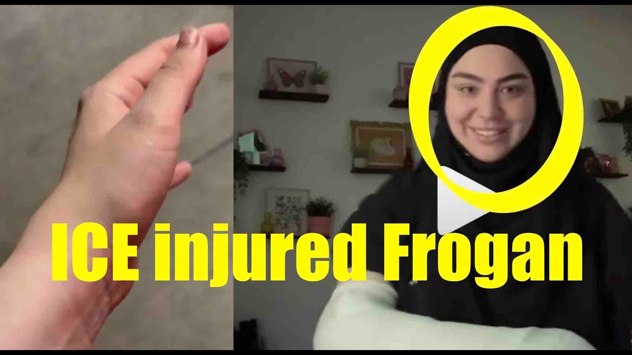 ICE Injured Frogan Hand | Ethan Klein vs Frogan Lawsuit Explained - YouTube