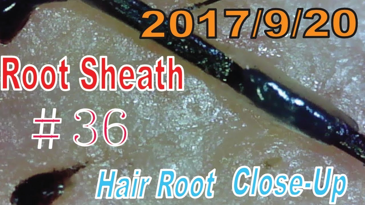 Hair Root / Root Sheath Close Up ＃36【 Non Stopin' Plucking Hair Root ...