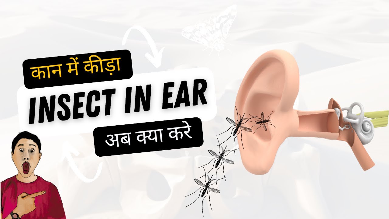 Live Insect into Ear canal |Clinical conditions for EAR |ENT related ...