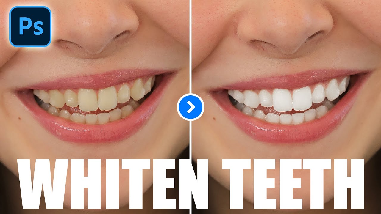 Easiest ways to whiten yellow teeth in Photoshop - YouTube