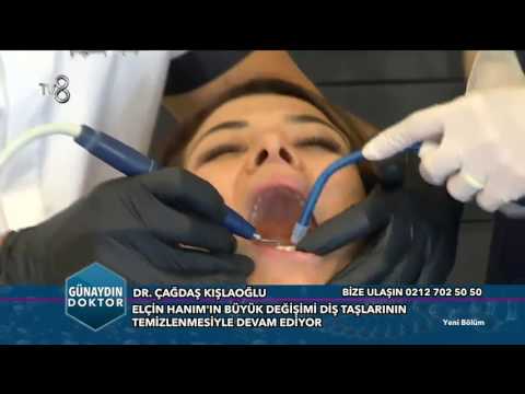 Diş Beyazlatma ve Pembe Estetik nasıl uygulanır?