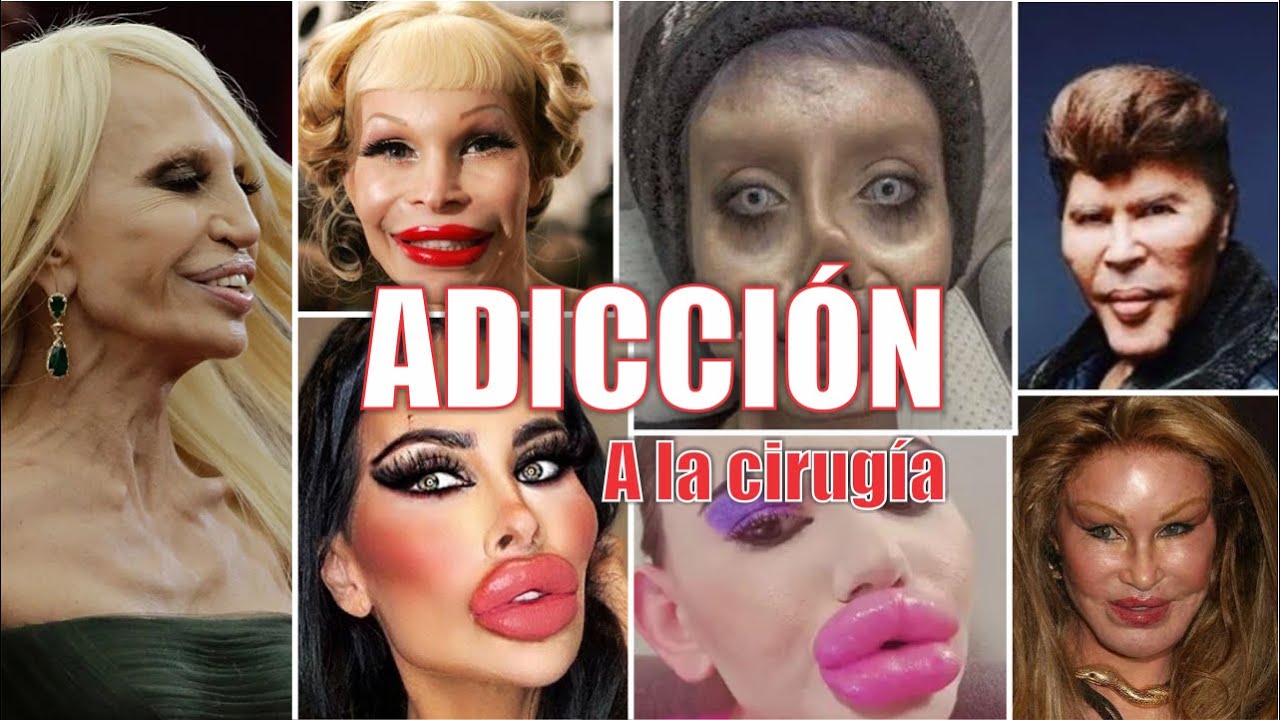 Terrible!!! ADICTOS a la Cirugía PLÁSTICA 🙈 Cirugía EXTREMA 🚫 PELIGRO 🤩 ...
