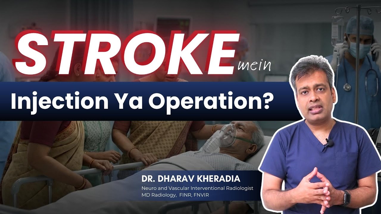Stroke Emergency Treatment Explained | Medicine vs Surgery vs Clot ...