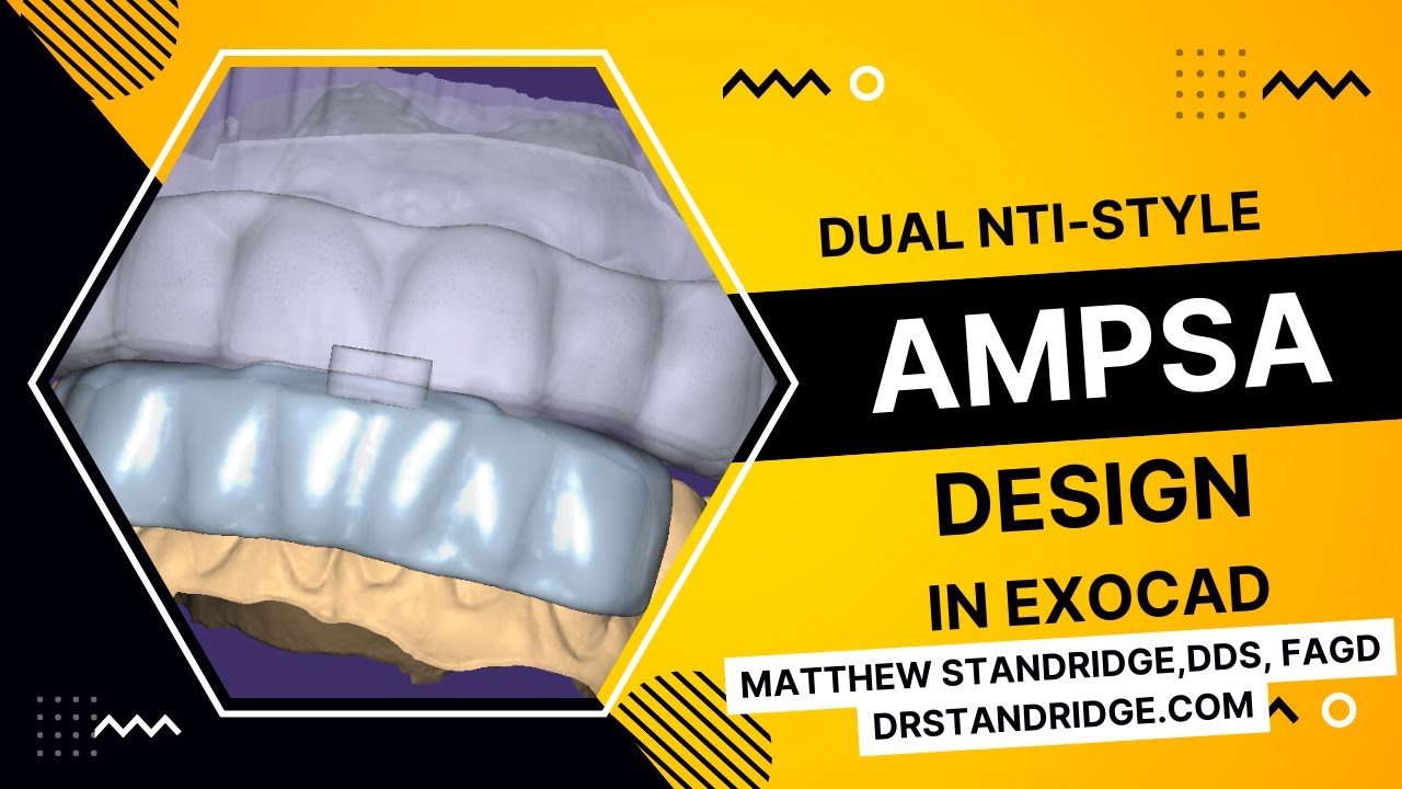 Dual AMPSA (NTI-Style) Nightguard in Exocad - YouTube