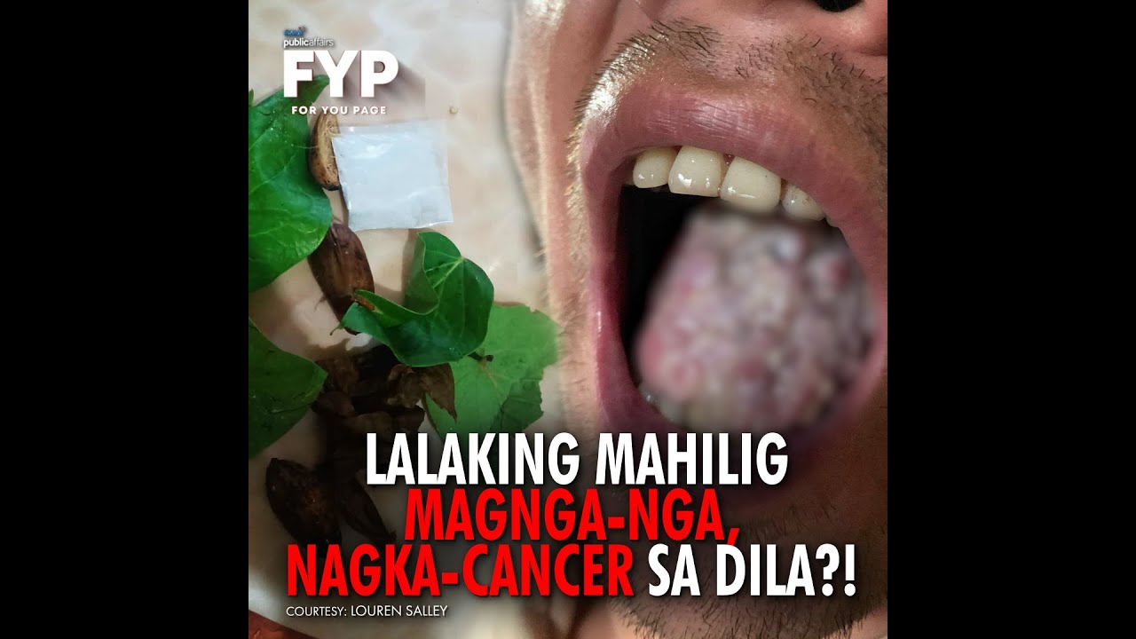 Lalaking mahilig mag-nga-nga, nagka-cancer sa dila?! | FYP - YouTube