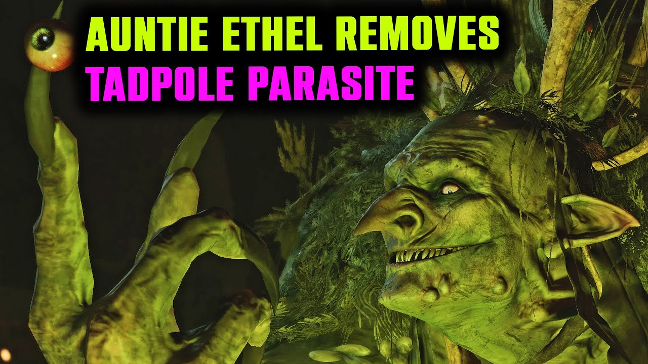 What Happens if you Let Auntie Ethel to Remove Tadpole Parasite ...