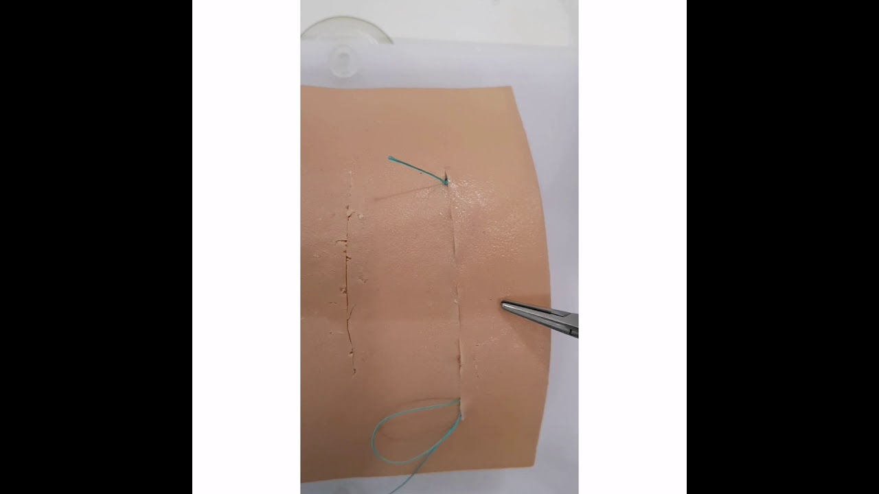 Subcuticular suture - YouTube
