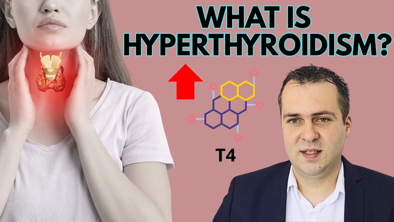 Hyperthyroidism Explained: Causes, Symptoms, and Treatment - YouTube