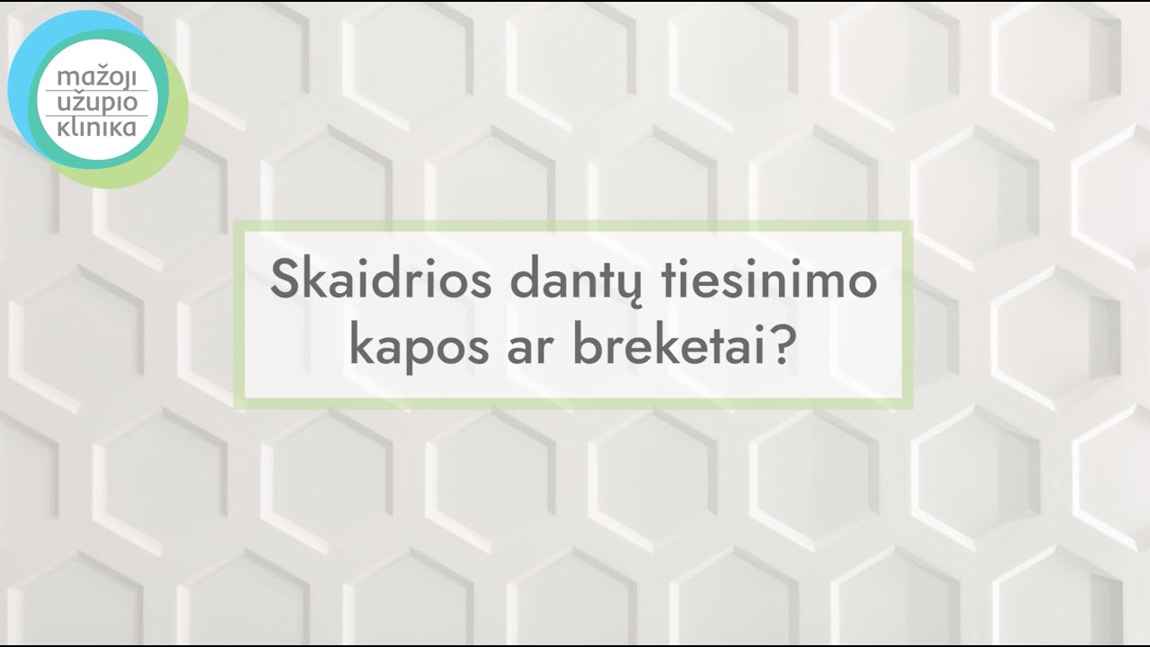 Dantų tiesinimo kapos ar breketai? - YouTube