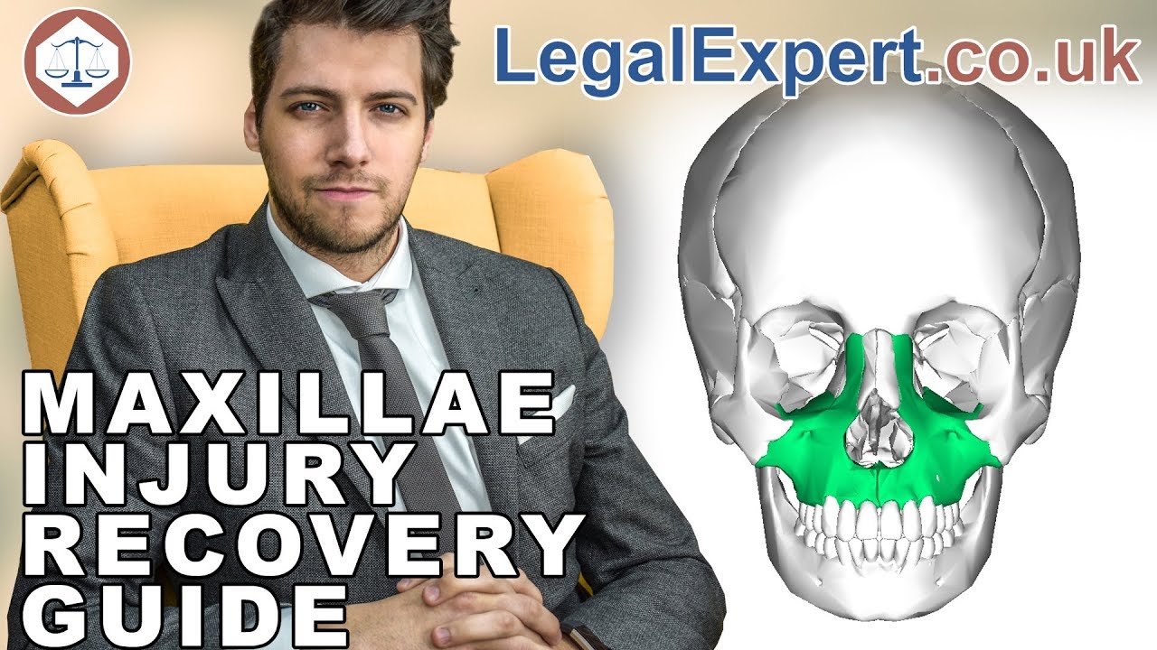Maxilla Injury Recovery Guide ( 2019 ) UK - YouTube