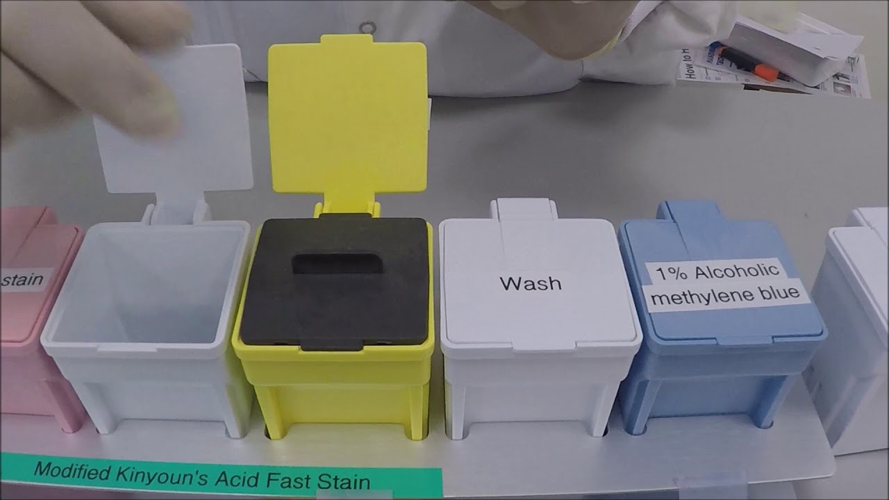 Kinyoun's staining for cryptosporidium - YouTube