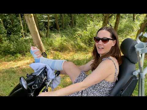Recovering from foot surgery (life update)