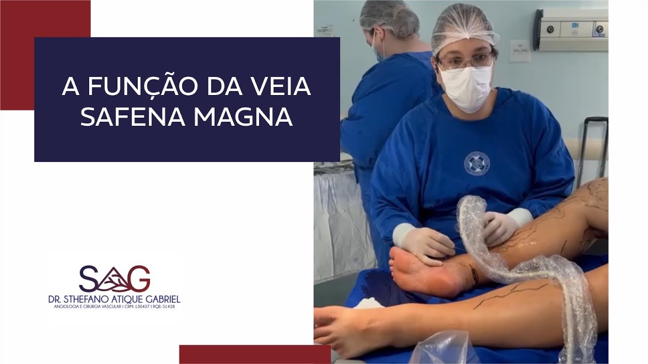 VEIA SAFENA E VARIZES - Dr. Sthefano Atique Gabriel - CRM 130437 - YouTube