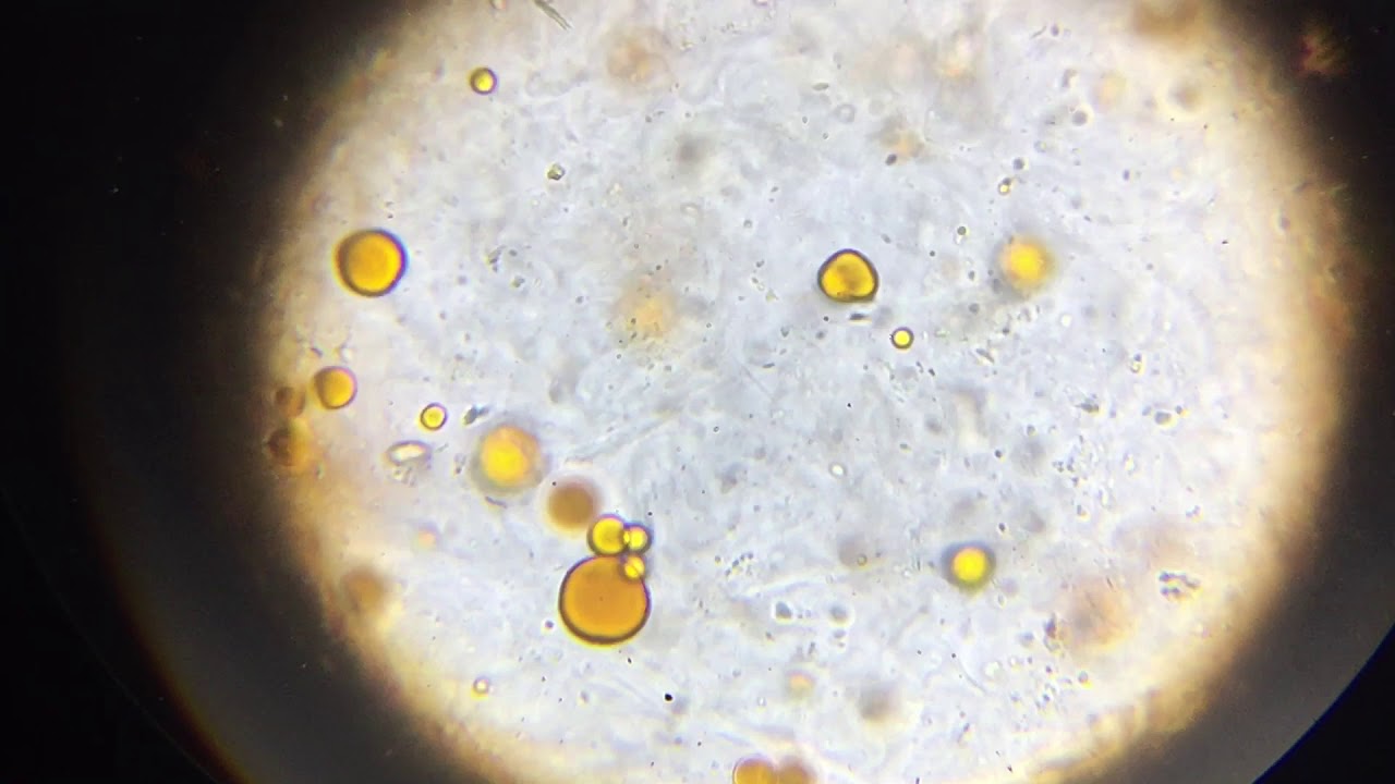 Soi Tương Ớt Dưới kính hiển vi xem có gì không / Check the Chili ...