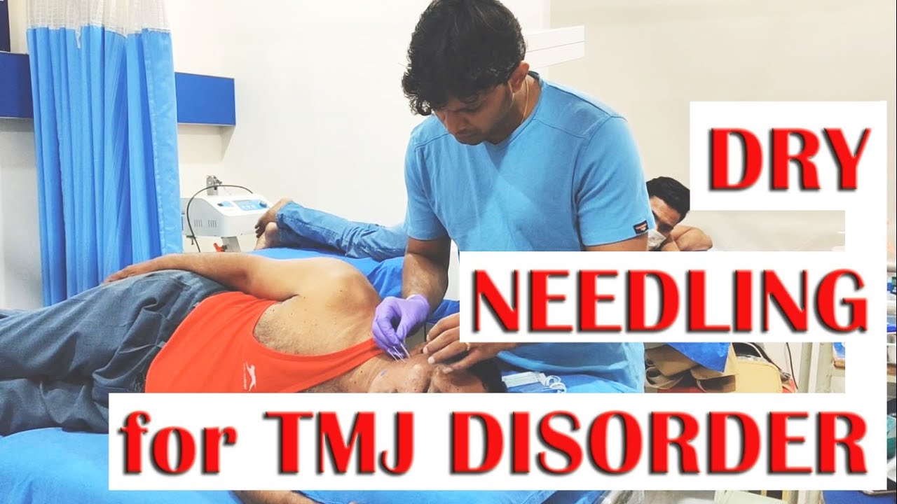 Dry needling for TMJ disorder with Jaw & Neck adjustment by Dr Rahul ...