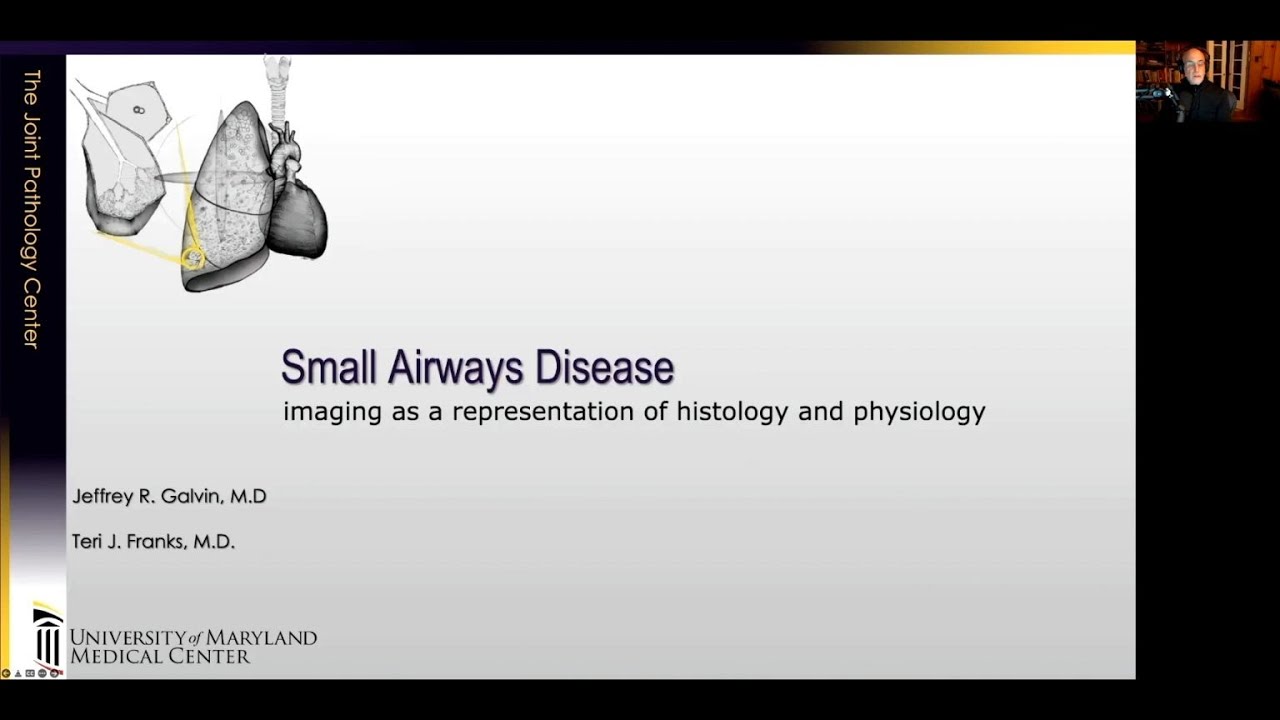 Small Airway Disease - YouTube