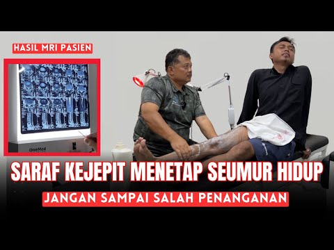 MCO ARIF -  SARAF KEJEPIT MENETAP SEUMUR HIDUP, JANGAN SAMPAI SALAH PENANGANAN