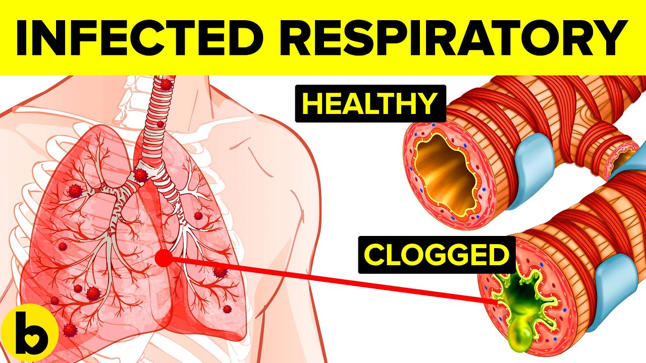 6 Ways You ll Get A Respiratory Infection YouTube 6-ways-you-ll-get-a-respiratory-infection-youtube