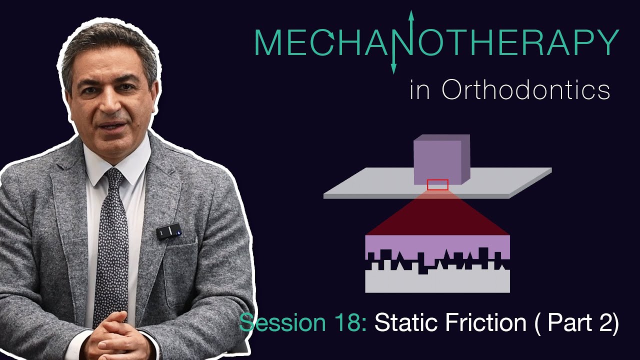 Mechanotherapy in Orthodontics Vol II: Static Friction (Part 2) #18 ...