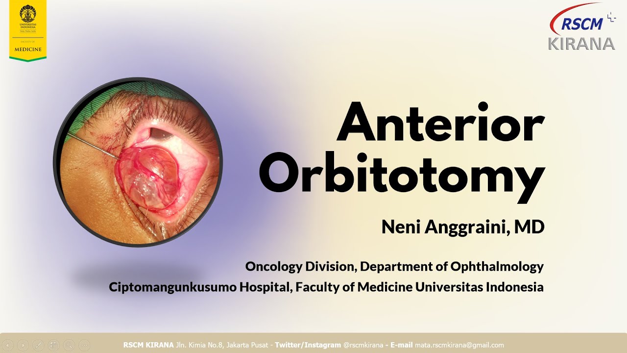 Anterior Orbitotomy - YouTube