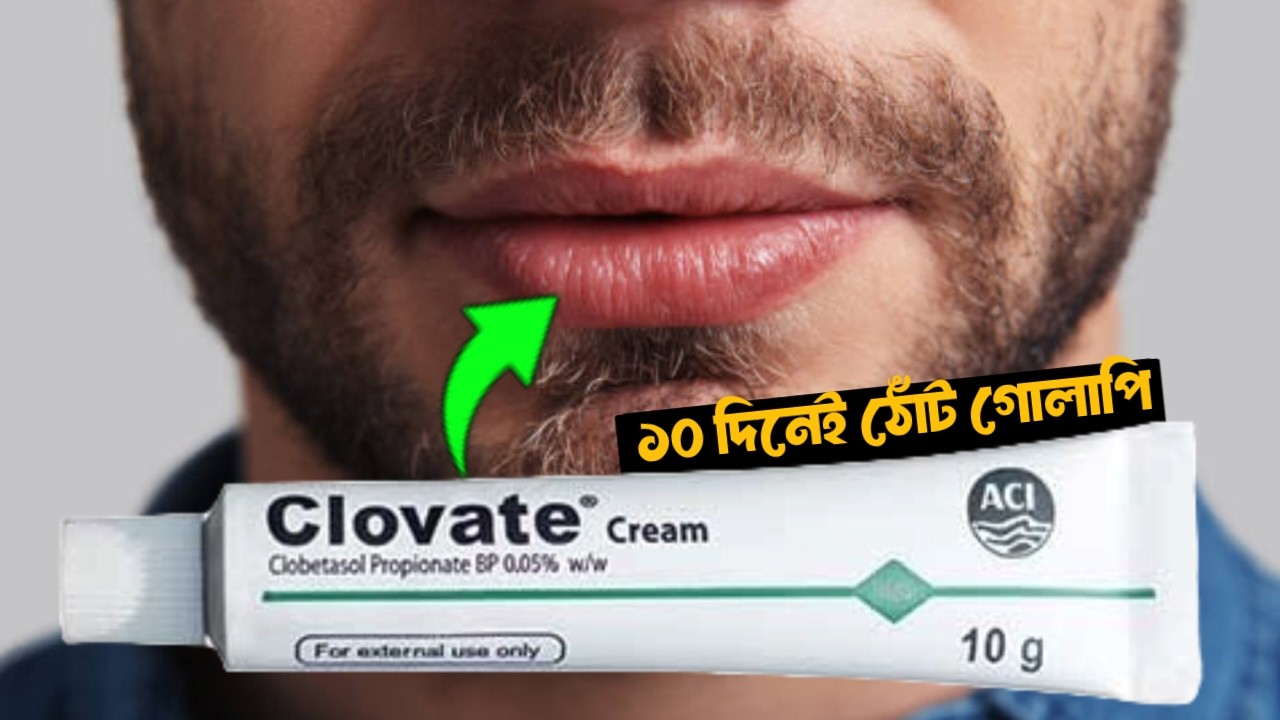 Permanently ঠোঁট গোলাপি হবে Clovate N Cream ব্যবহারের সঠিক নিয়ম 😱 Pink ...