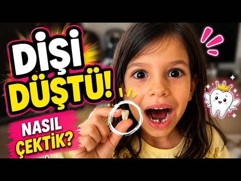 ESMA GÜNEŞ’İN DİŞİ DÜŞTÜ! 🦷 DİŞİNİ NASIL ÇEKTİK? | ANNE KIZ VLOG