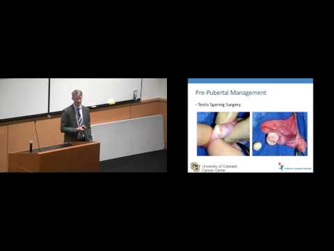 Management of Children, Adolescents, and Young Adults with Testicular Cacner